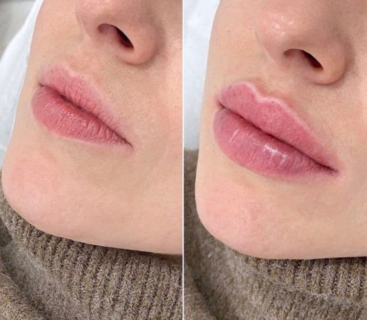 Evolution Aesthetics Clinic